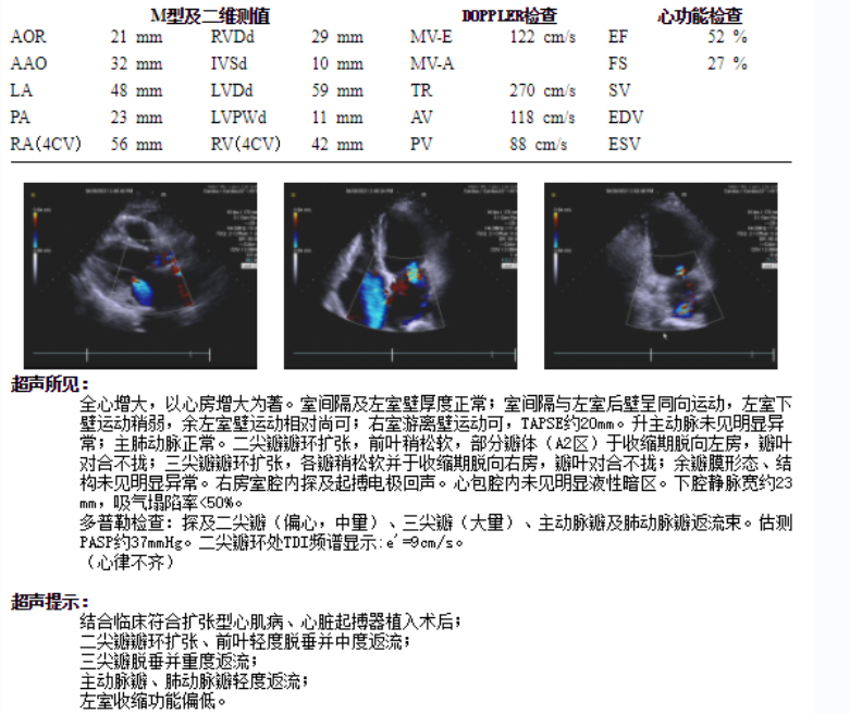 中山大学孙逸仙纪念医院陈样新教授团队完成MitraClip™治疗CRT术后重度二尖瓣关闭不全患者一例-医谱