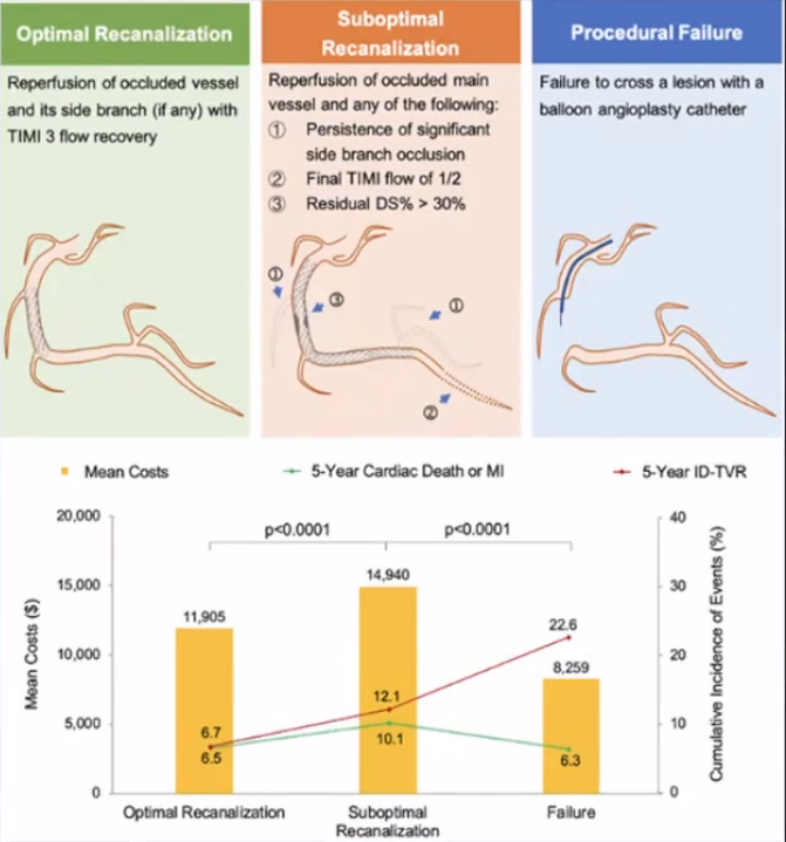 赵杰教授：内膜下斑块修饰技术启动时机和注意事项-医谱