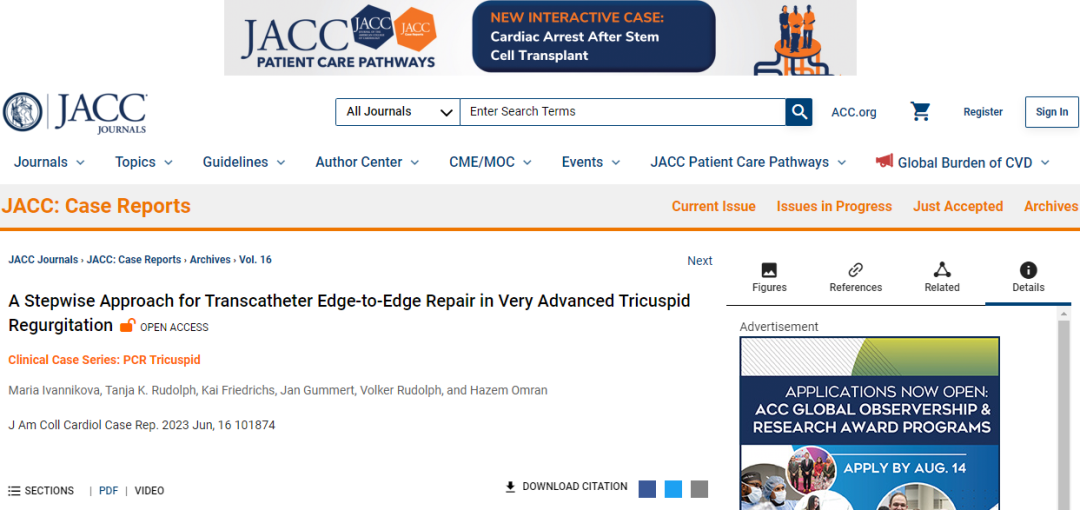 国际动态丨JACC Case Report 2：经导管缘对缘修复极重度三尖瓣反流的逐步方法-医谱